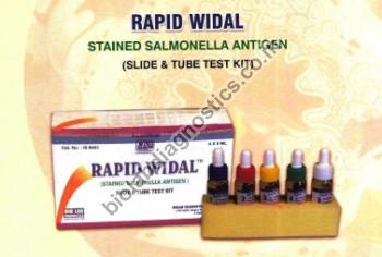 (2+2)X5ml Typhoid Test Kit at Rs 644 / Kit in Mumbai | BIOLAB ...