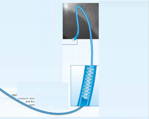 Angiography Catheter - Event Medi Systems, Delhi, Delhi